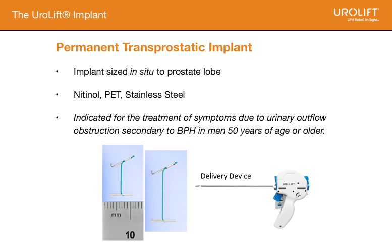 Minimally invasive prostate treatment in Essex | BPH Relief | Urolift
